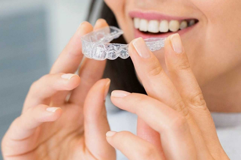 Alineadores Dentales en México - Ideal Dental